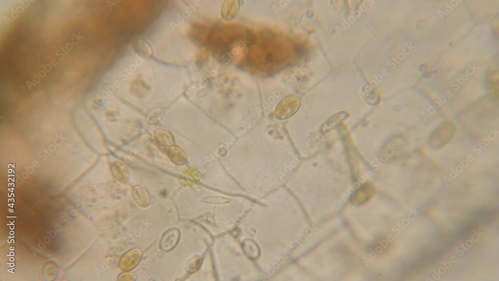 Chloroplast Under a Microscope Dead Plant. Cell Division. Dead Plant ...