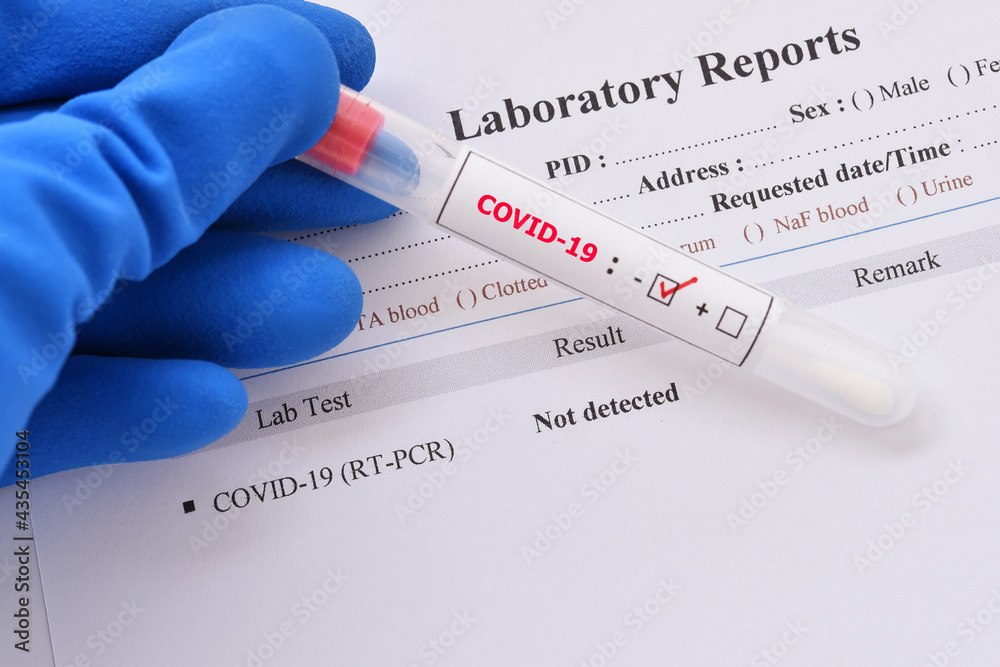 Nasopharyngeal swab not detected with COVID-19 test by using RT-PCR ...