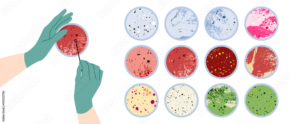 Scientist's hand in glove holding Petri dish, plate with agar ...