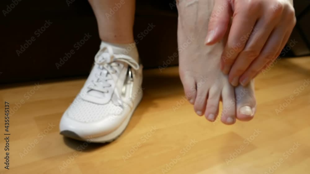 woman takes off her white sneakers and scratches her leg, redness ...