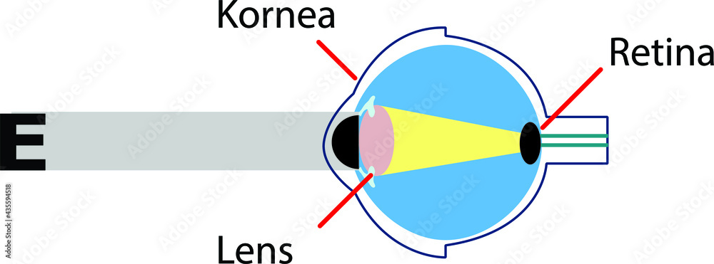 Vector Illustration of an Eye Anatomy Astigmatic Stock Vector | Adobe Stock