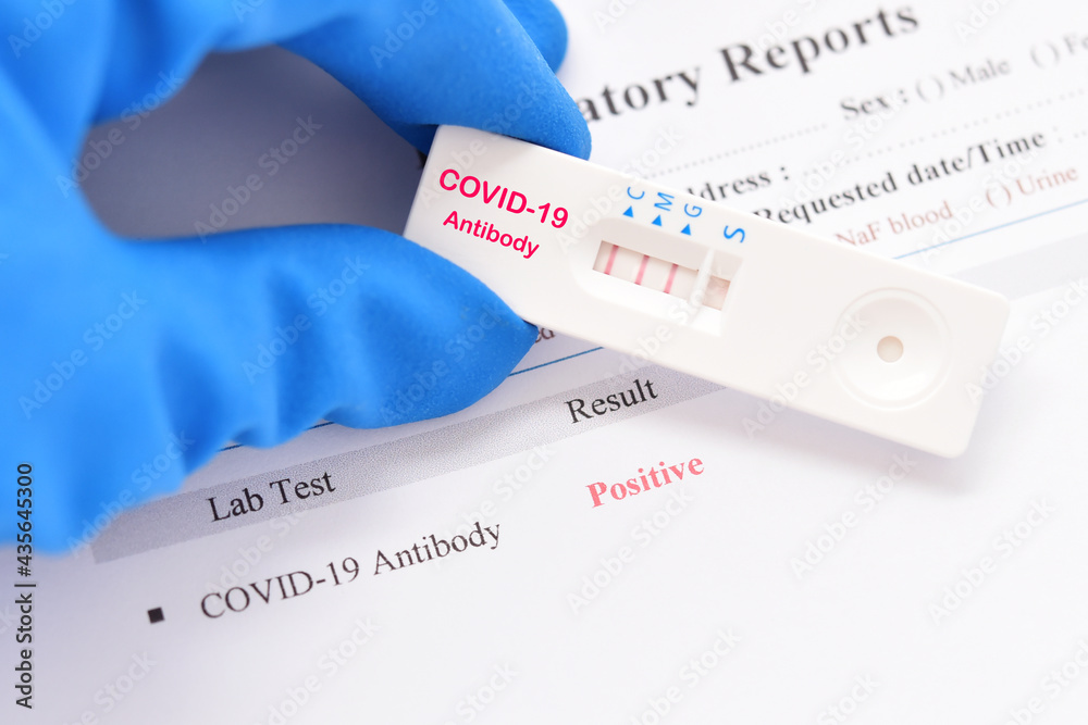 Positive test result of COVID-19 virus by using rapid card test ...