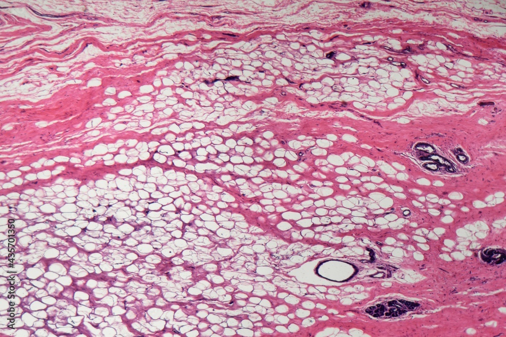 Human mammary gland cells under the microscope Stock-Foto | Adobe Stock