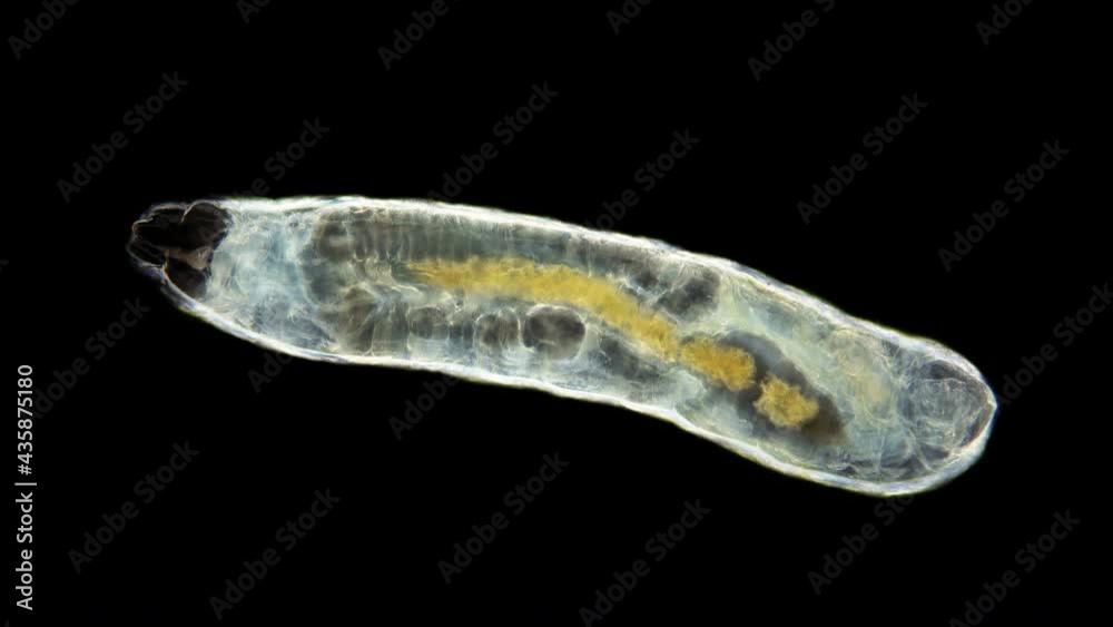 Larva of soil gnats, Sciaridae family under microscope. A well-known ...