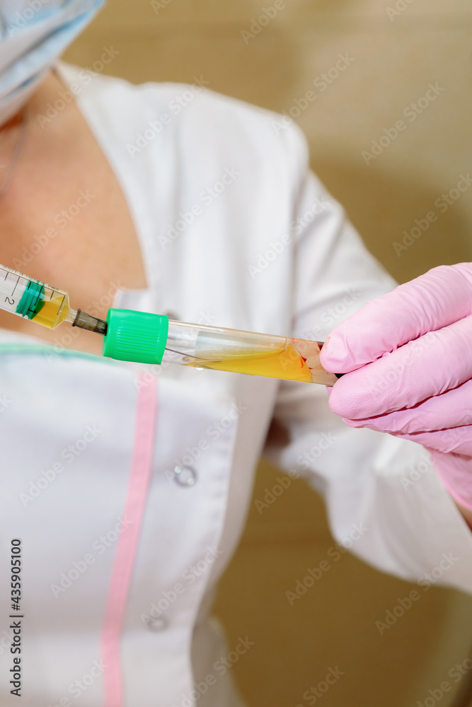 The specialist draws out the blood plasma from the test tube using a ...