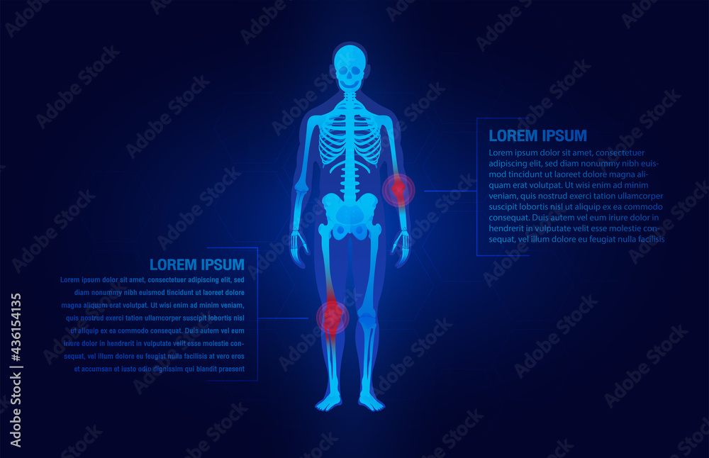 Pain of the elbow and knee joints concept as skeleton. Blue background ...