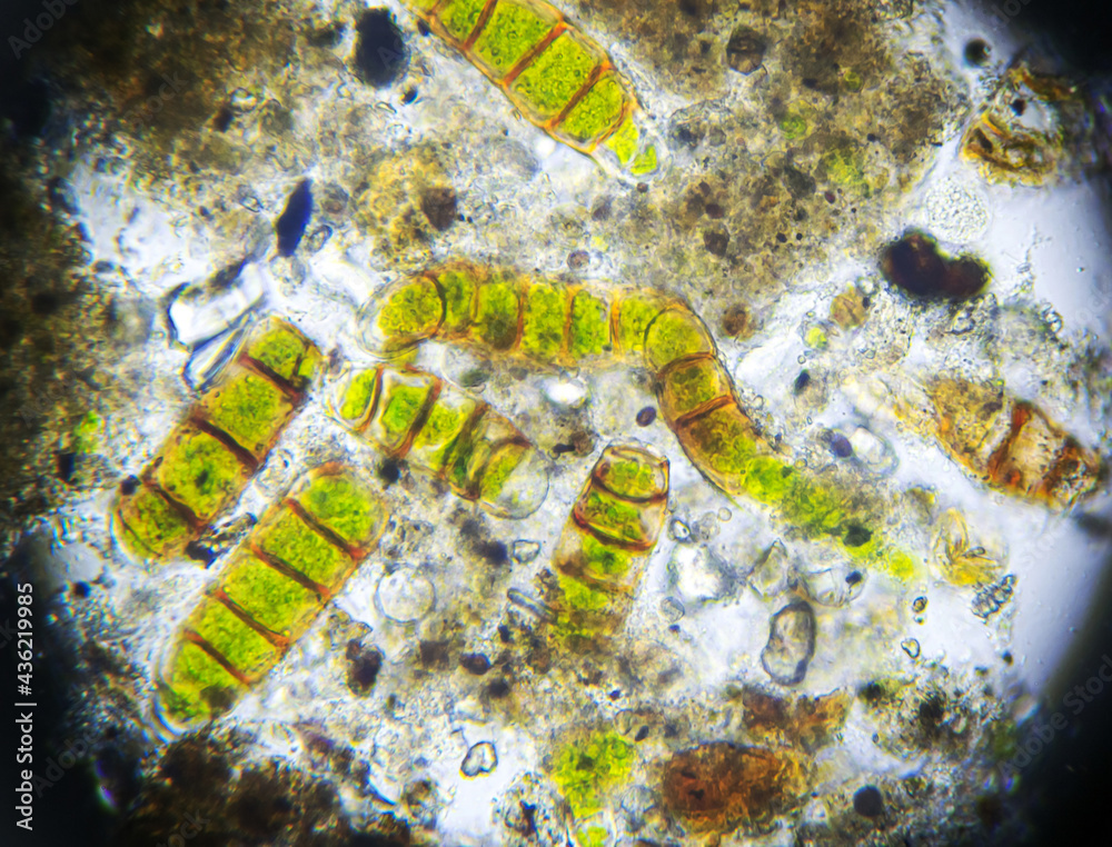 Microalgae under a microscope, sample taken from moss Stock Photo ...