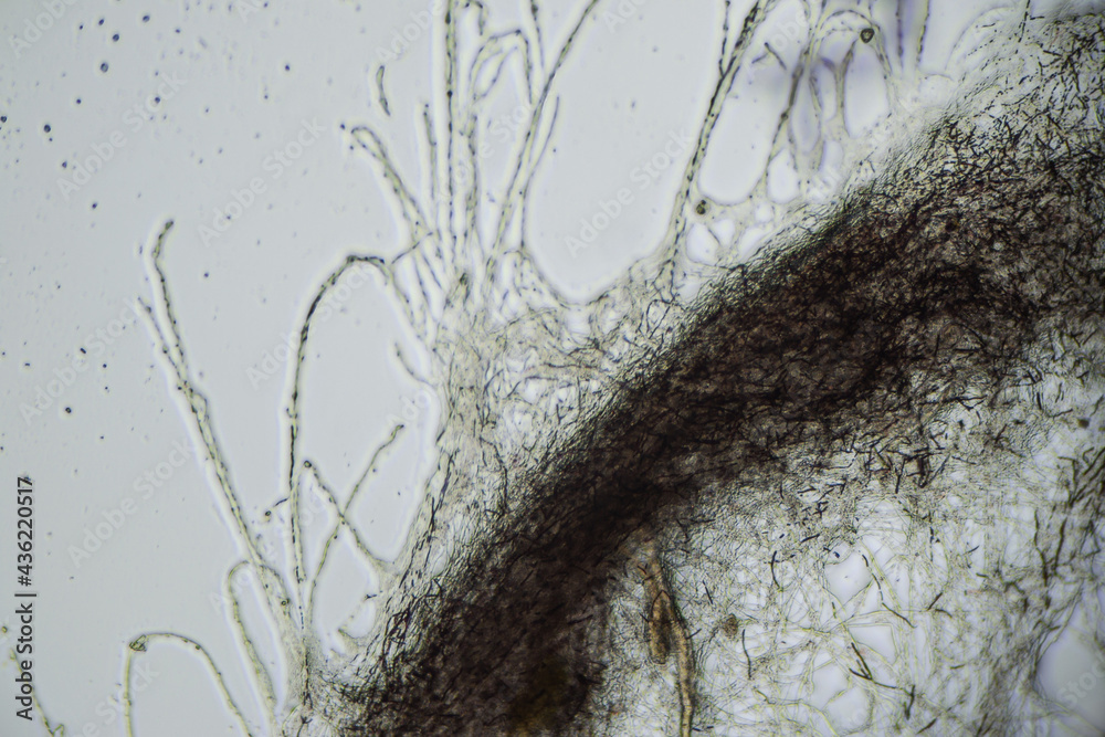 Kombucha tea macro close up under the light microscope, magnification ...