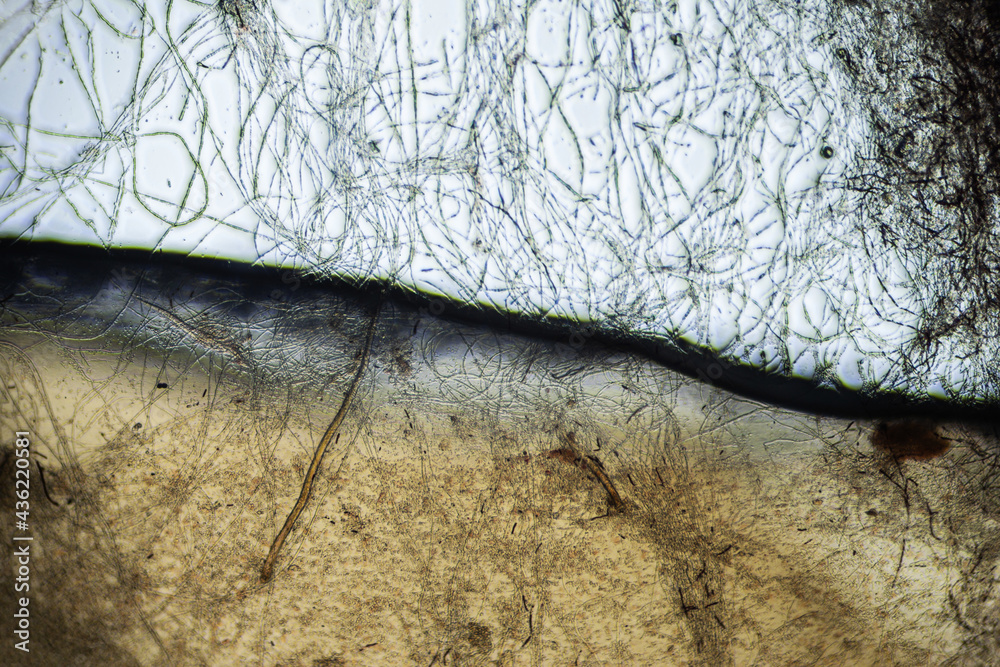 Kombucha tea macro close up under the light microscope, magnification ...
