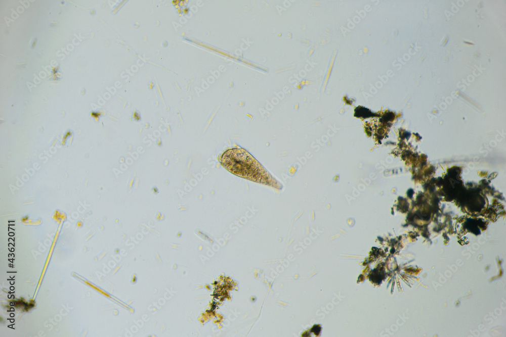 Ciliates Stentor found in freshwater pond under the light microscope ...