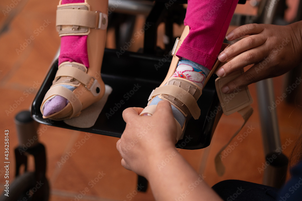 baby with physical disability using foot orthosis and mother adjusting ...