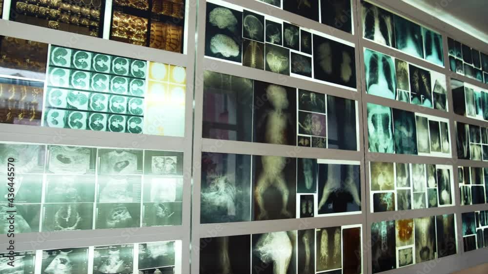 Wall with multiple MRI photos. Many x-ray photographs showing people's ...
