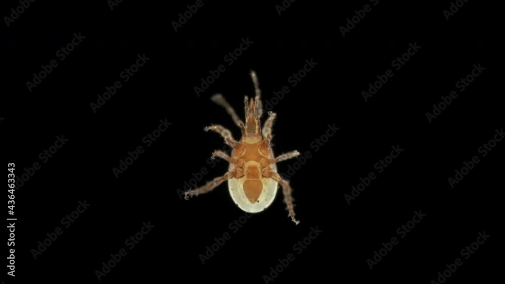 Predatory mite Macrocheles robustulus under a microscope, family ...