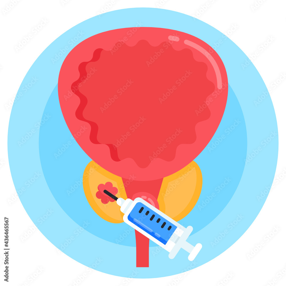 Prostate Biopsy Stock Vector | Adobe Stock