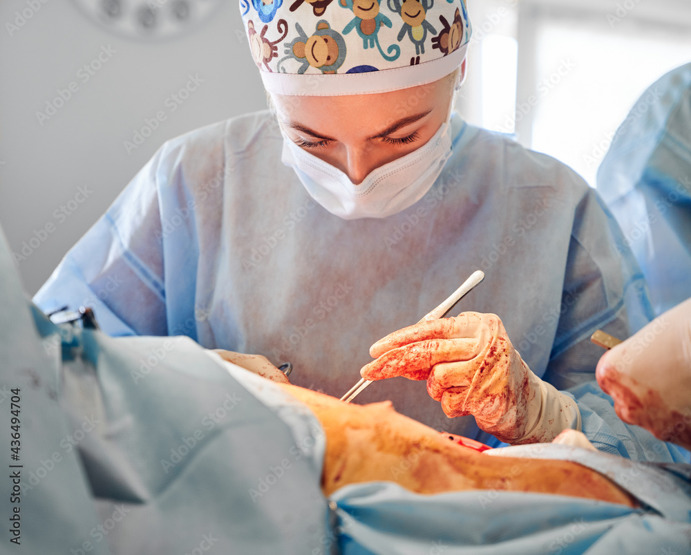 Female surgeon in medical mask performing tummy tuck surgery in ...