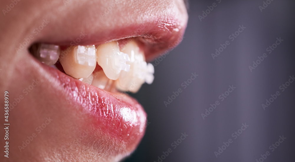 Horizontal close-up snapshot of beautiful woman's smile, demonstrating ...