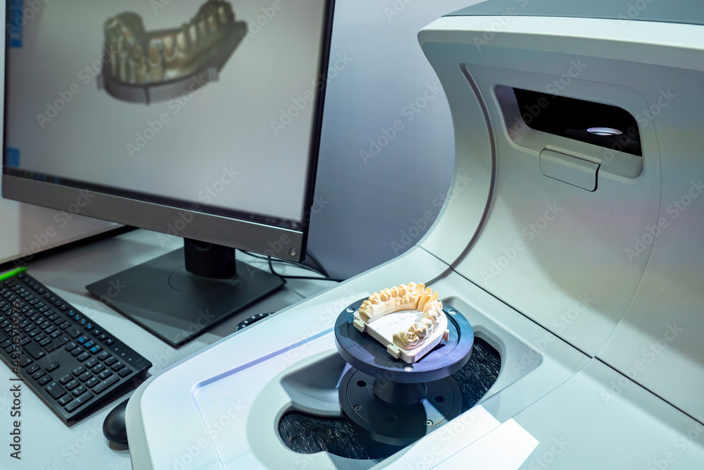 Scanner for creating three-dimensional image of prostheses. 3D scanner ...