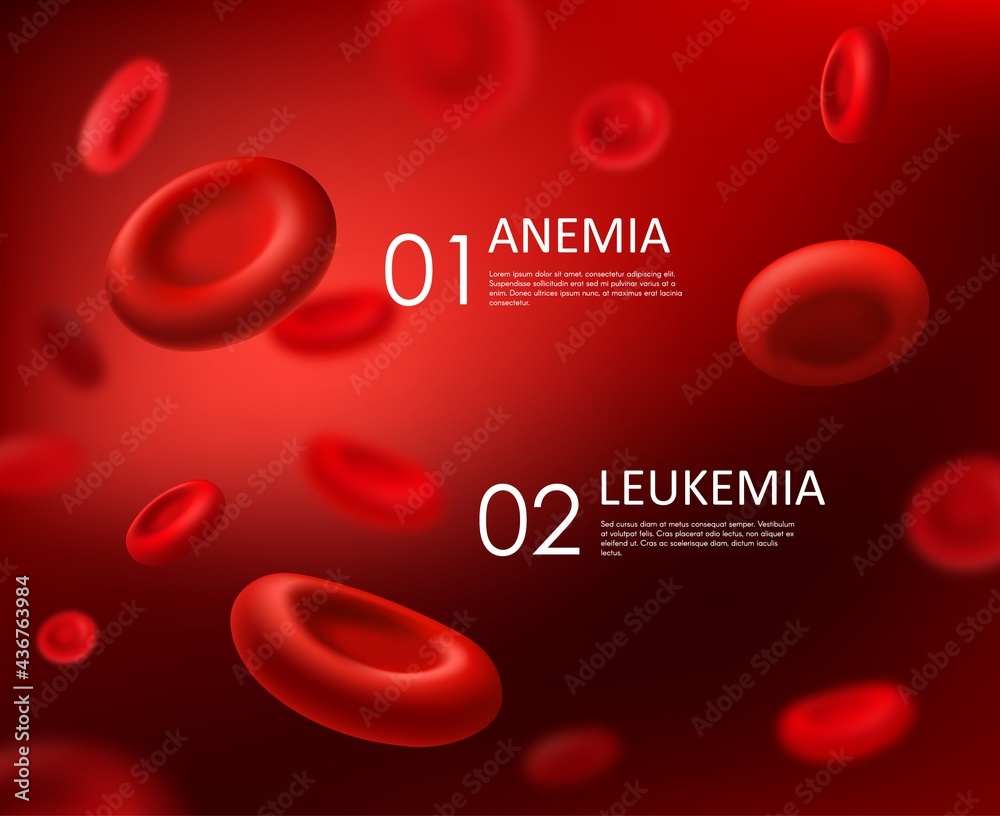 Plakat Anemia and leukemia, blood diseases vector background with red ...