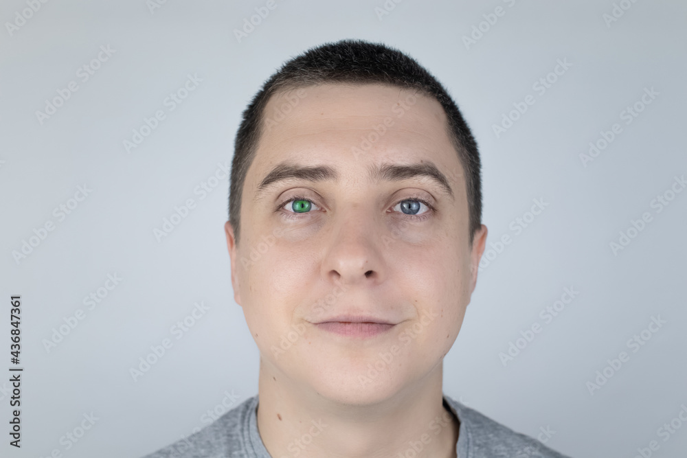 A man with different color eyes looks into the frame. The right eye is ...