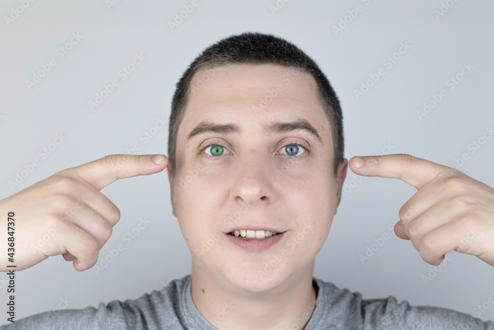 A man with different color eyes looks into the frame. The right eye is ...