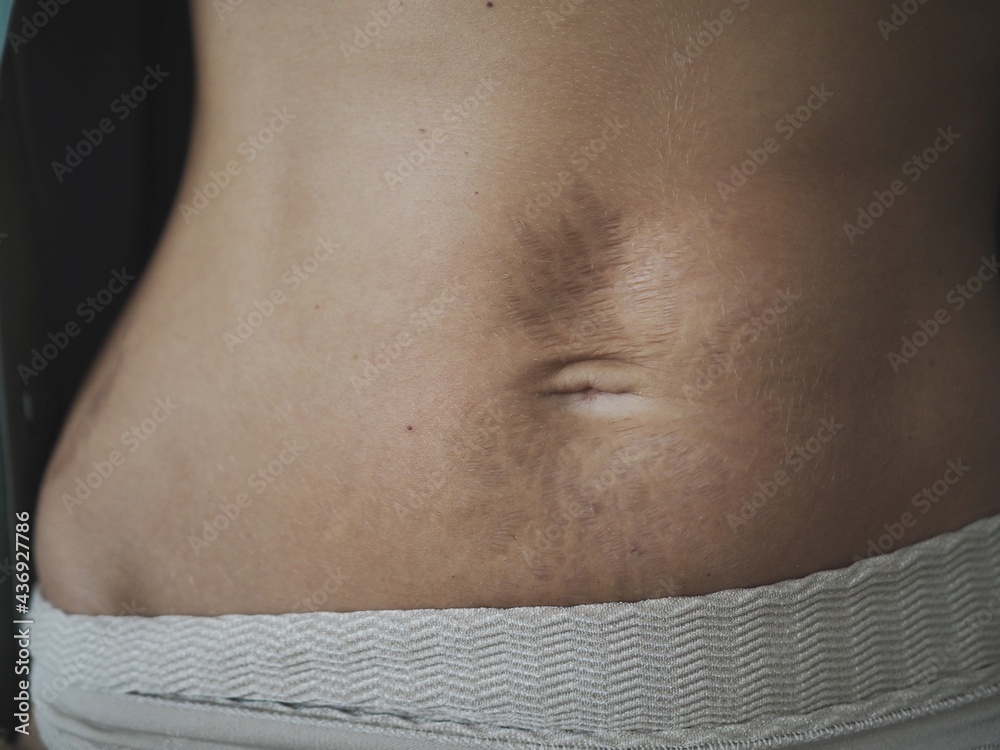 young beautiful woman makes a dry brush massage, esthetics and body ...