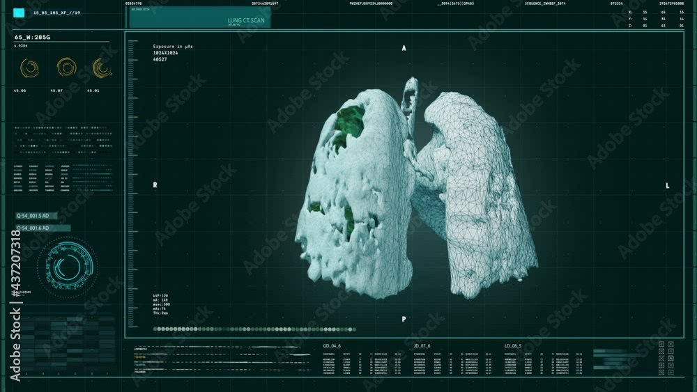 Medical Software Loading. Analyzing Genetic Mutations of the Human ...