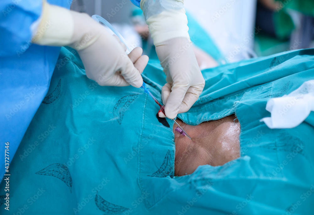 anesthetist setting central venous catheter to patient before open ...
