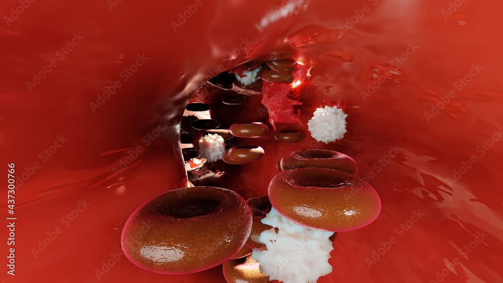 Hemostasis. Red blood cells and platelets in the blood vessel. Basic ...