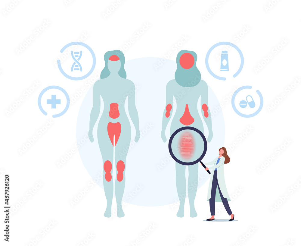 Psoriasis Concept. Doctor Character Show Affected Areas on Human Body ...