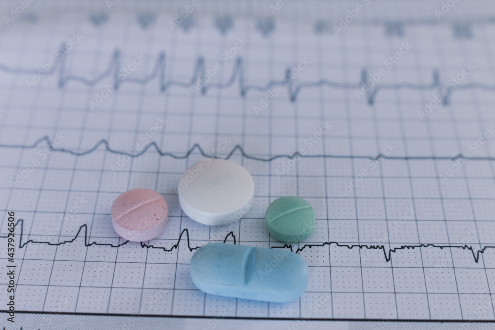 Medications for the heart on electrocardiograms with arrhythmias. Post ...