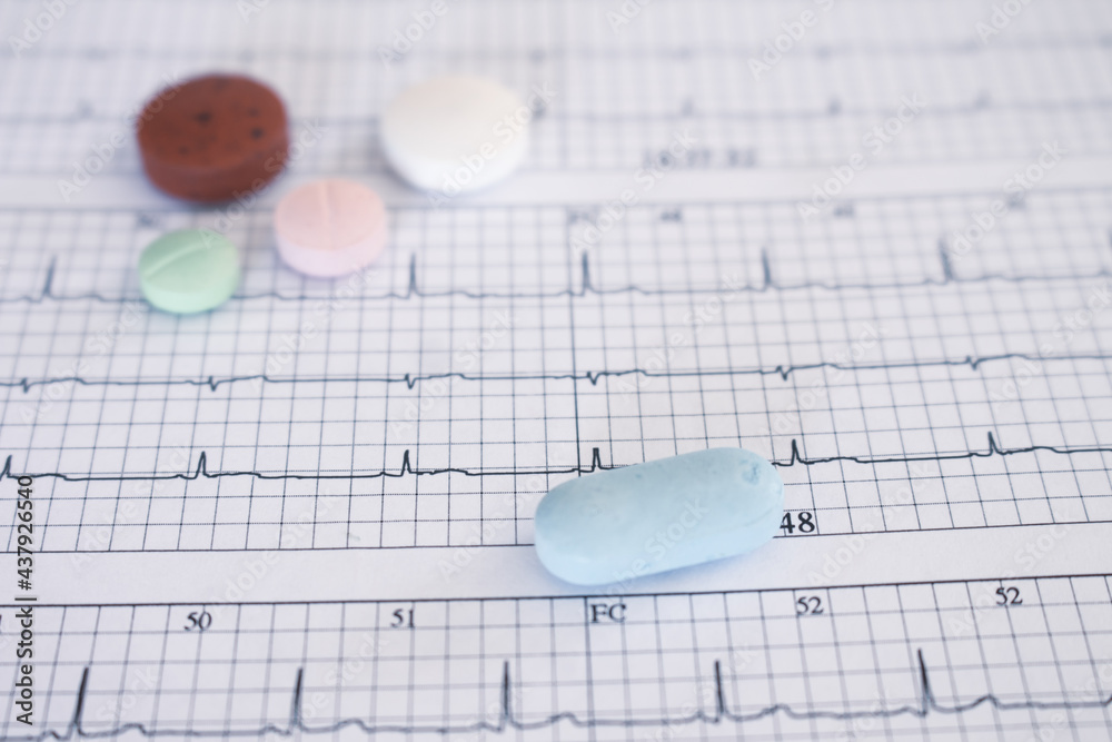 Medications for the heart on electrocardiograms. . Post covid cardiovascular disease concept ...