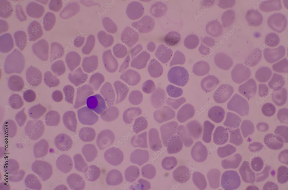 Nucleated Red Blood Cells