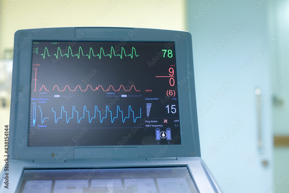 EKG monitor in intra aortic balloon pump machine. Medical equipment ...