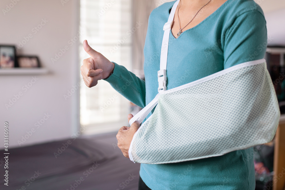 Patient woman showing thump up while wearing arm sling for relieve ...