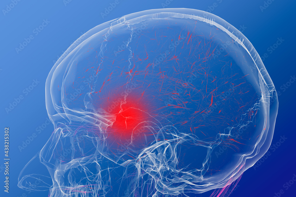 Pain in the temporal lobes of the head. X-ray of the human body. 3d ...