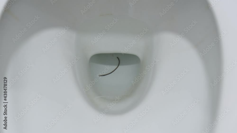 Ascariasis parasite worm in human intestine on toilet Stock Video ...