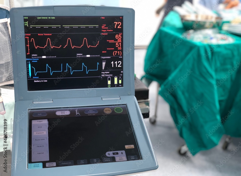 Intra aortic balloon pump (IABP) machine in operating room. Stock Photo ...