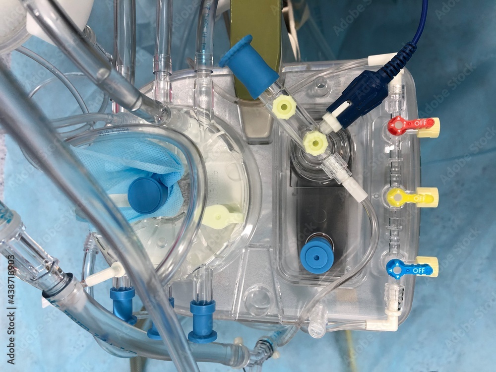 Venous reservoir and oxygenator connected with heart lung machine by ...
