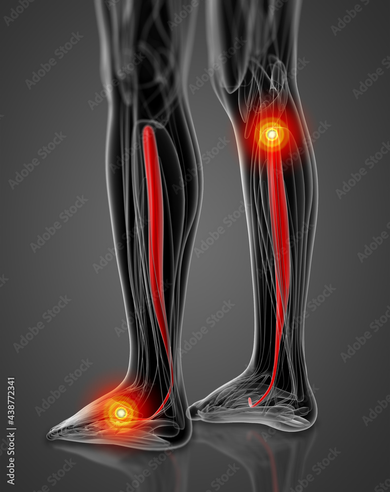 medical illustration of the tibialis posterior ilustração do Stock ...