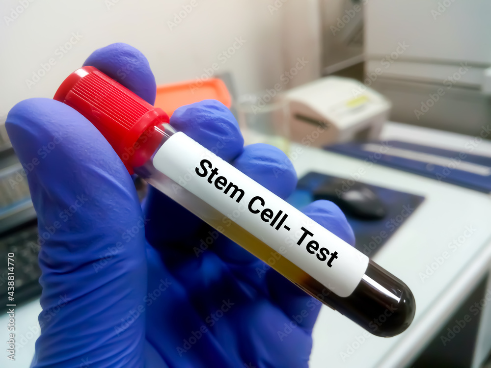 Blood sample for stem cell test. Stem cell researcher working in ...