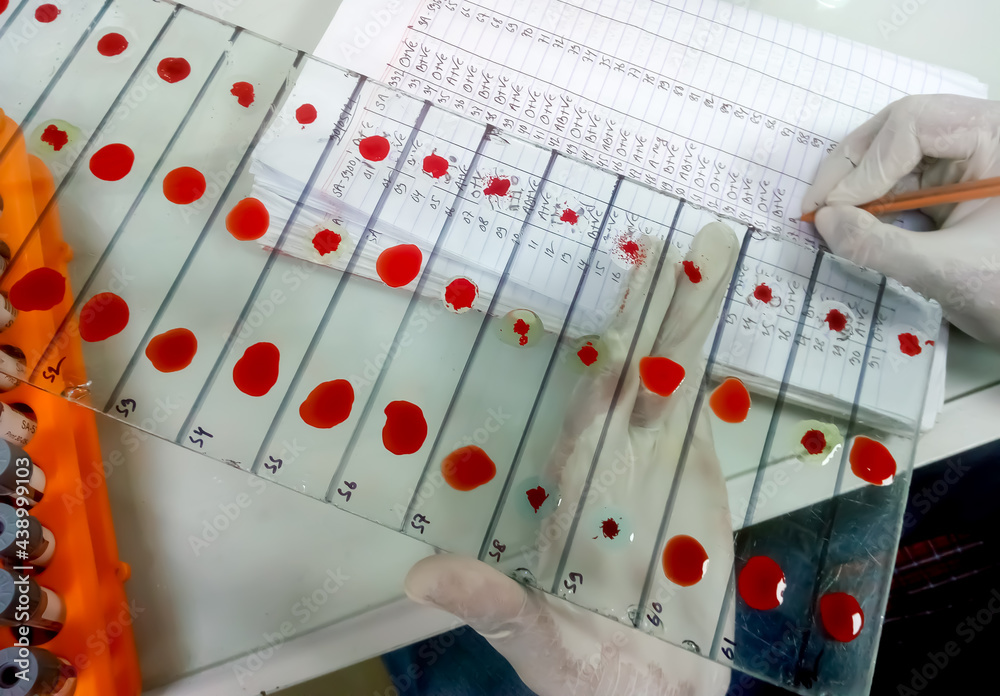 Foto de Doctor or scientist check blood group of patient or donor. ABO ...