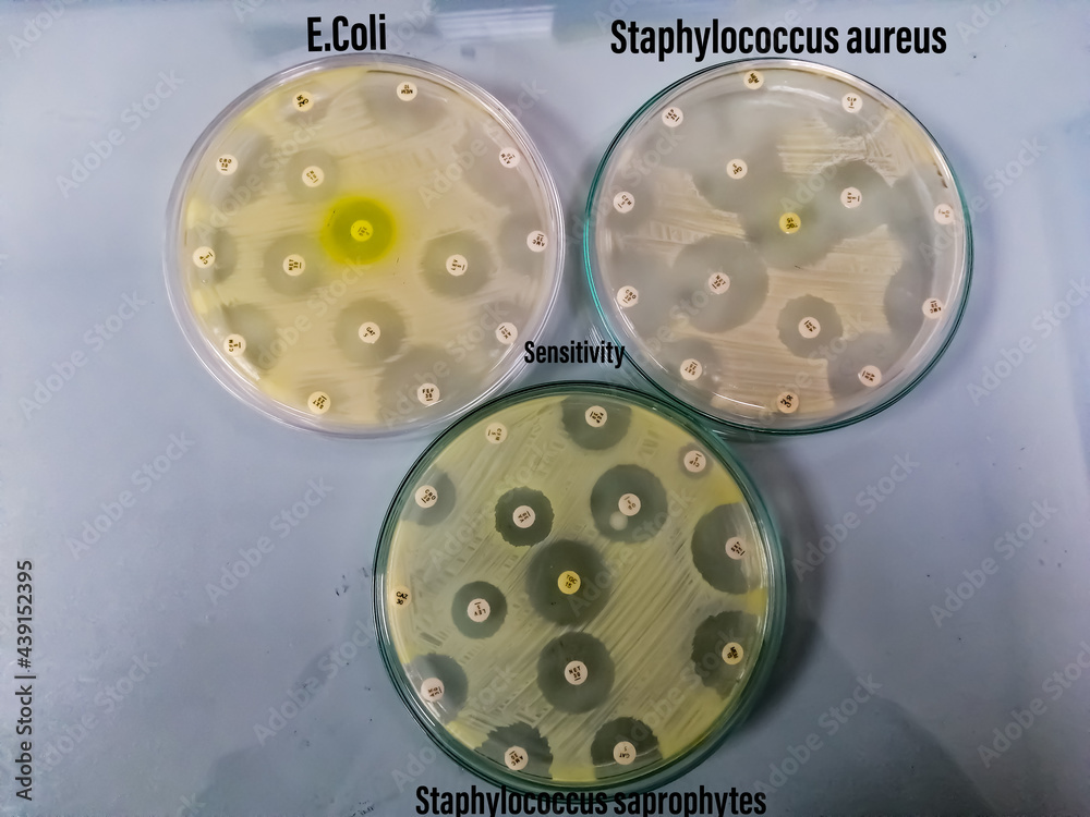 Antimicrobial susceptibility testing in culture plate. Drug sensitivity ...