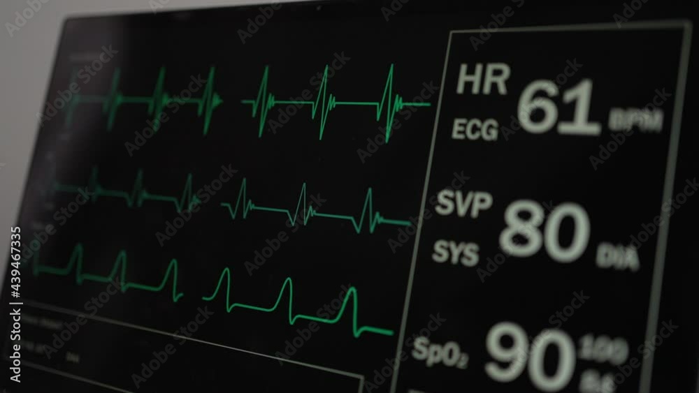 Looped: Patient monitor displays vital signs ECG electrocardiogram EKG ...