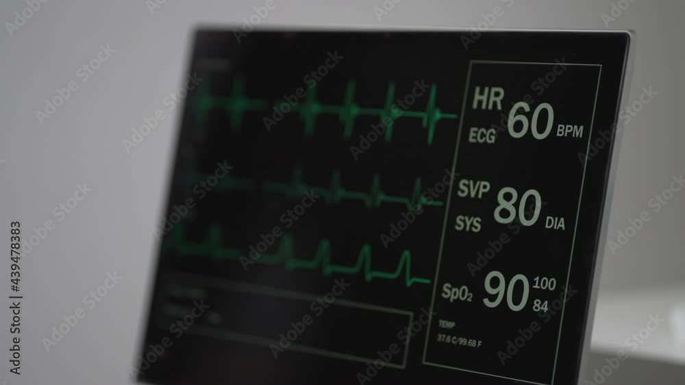 Looped: Patient monitor displays vital signs ECG electrocardiogram EKG ...