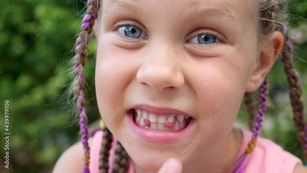Cute little cute child girl smiles and shows first wobby tooth. Dental ...