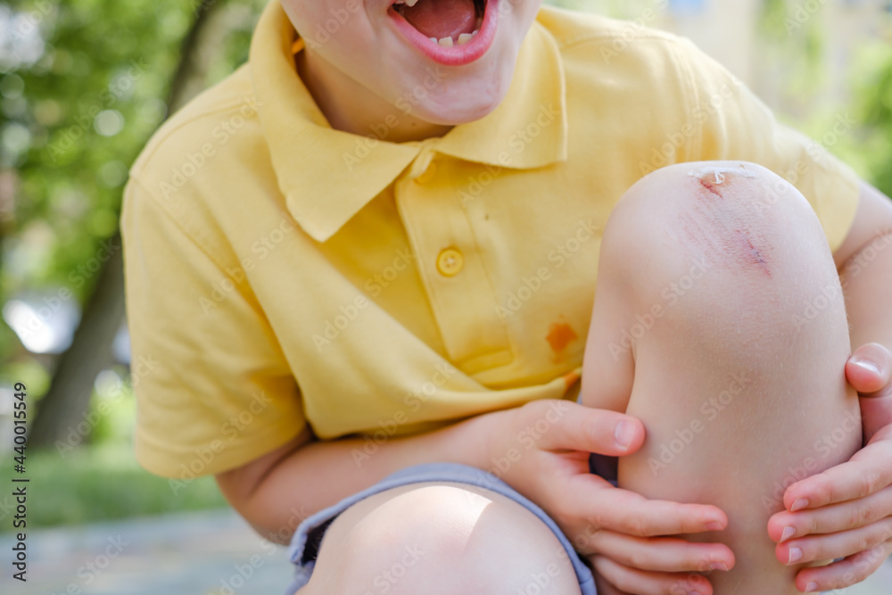 The boy holds his knee with his hands and screams in pain. Childrens ...