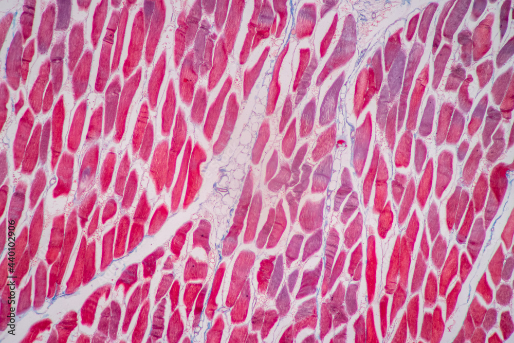 Characteristics of anatomy and Histological sample Striated (Skeletal ...