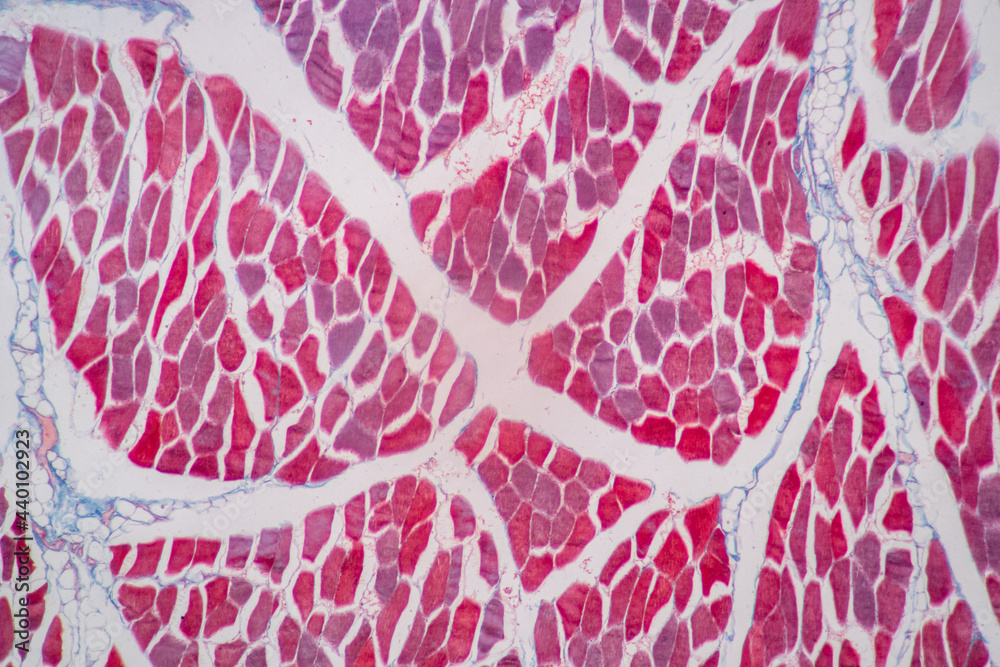 Characteristics of anatomy and Histological sample Striated (Skeletal ...