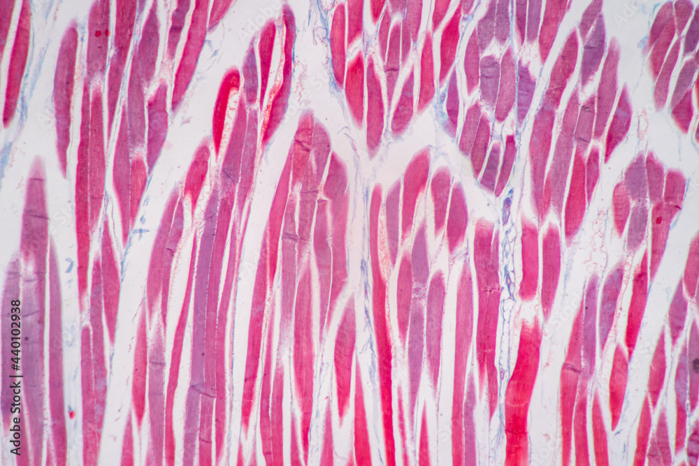 Characteristics of anatomy and Histological sample Striated (Skeletal ...