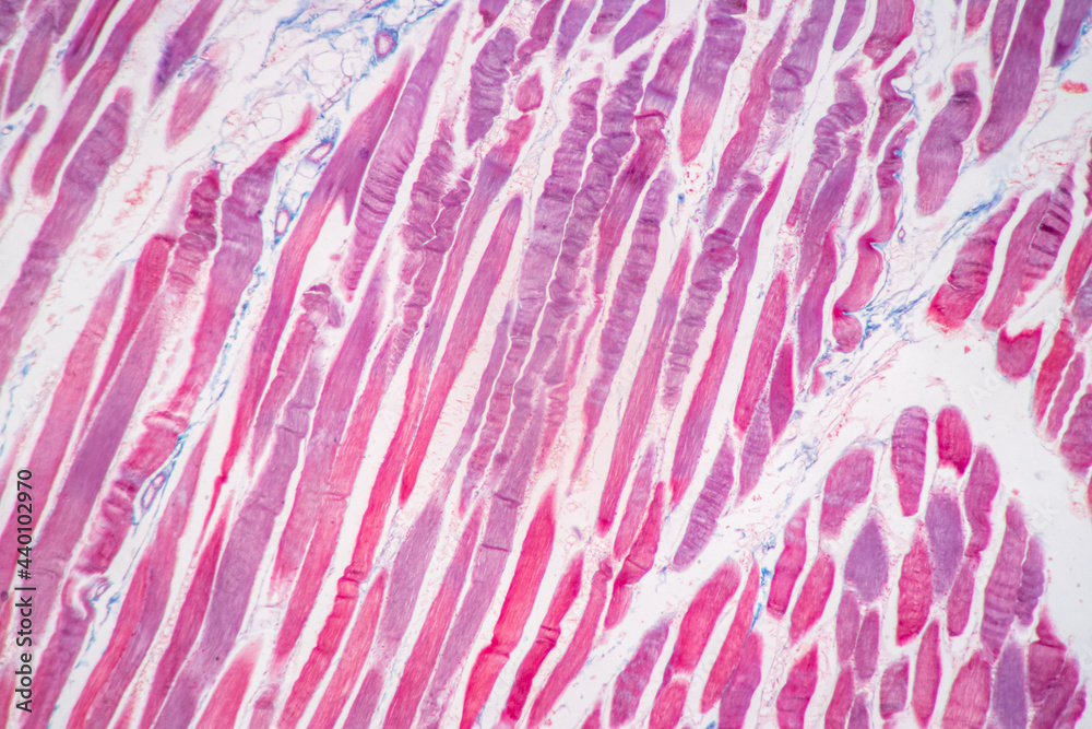 Characteristics of anatomy and Histological sample Striated (Skeletal ...